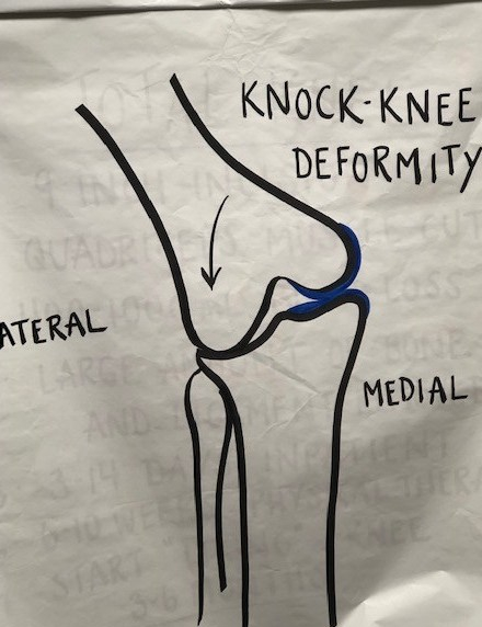 Understanding your knee – Dr. Martin Redish